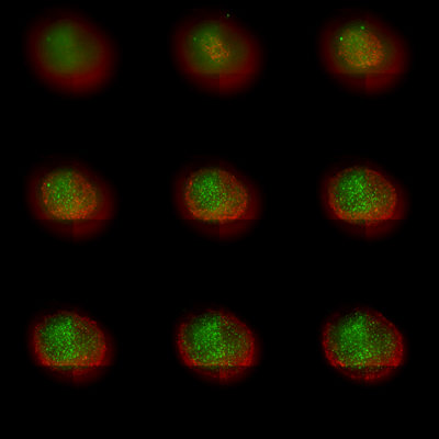 Visikol® - How to Label and Image Dense Neuronal Spheroids in 3D | Visikol