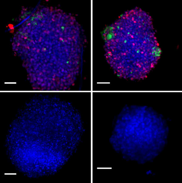 Visikol® - Blog Post: Optimizing staining protocols with Visikol HISTO ...