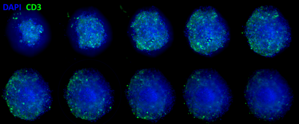 Blog Post: Immune Cell Infiltration Assay | Visikol
