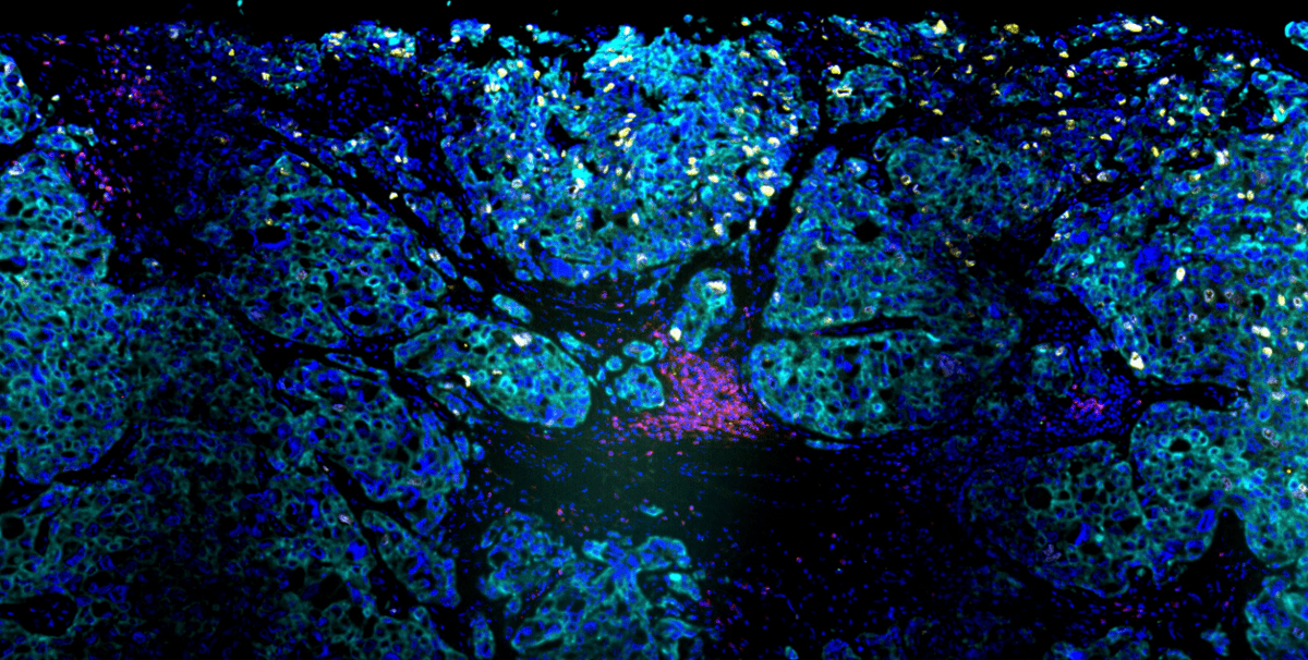 Blog Post: Fluorescent Multiplex Imaging Review | Visikol