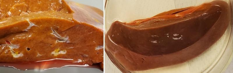 Precision-Cut Liver Slices - Study Formats