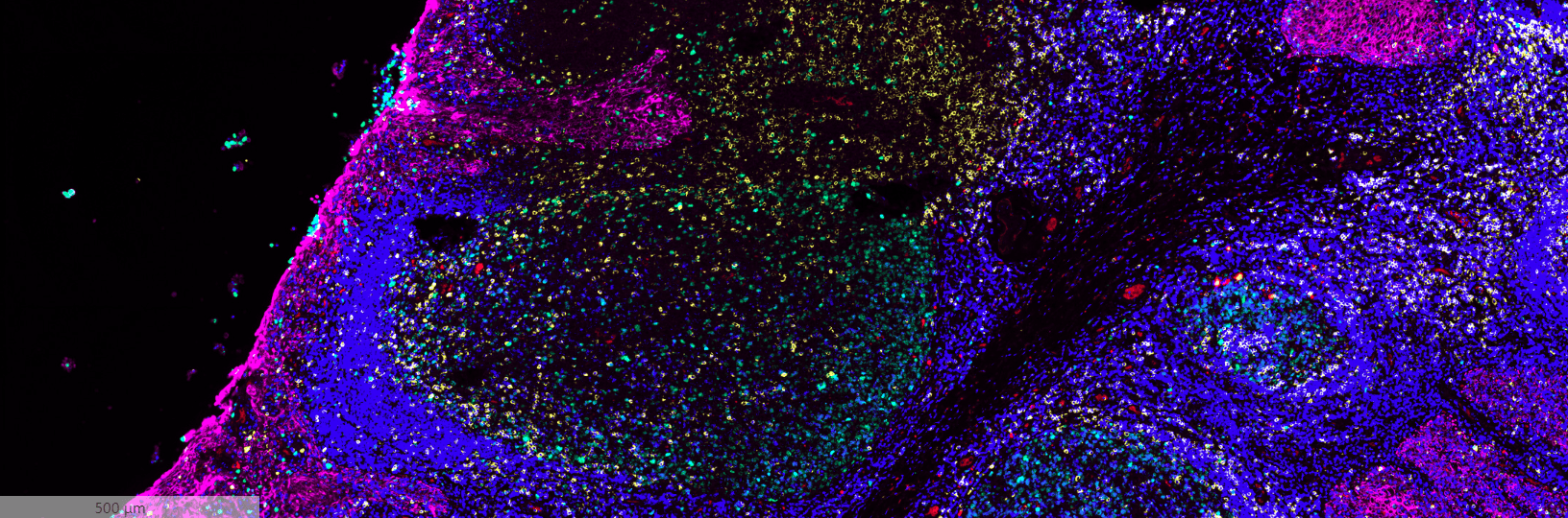Highly Multiplexed Immunohistochemistry for Your Study Highly Multiplexed Immunohistochemistry for Your Study