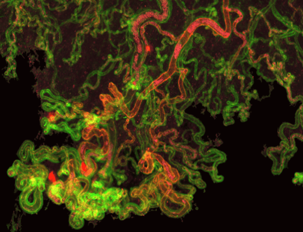 Clinical Applications of Tissue Clearing and 3D Microscopy