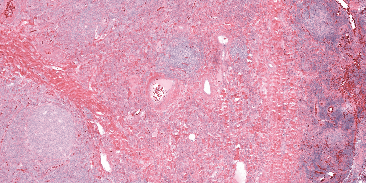 Nuclear Staining: Overview of Hematoxylin | Visikol