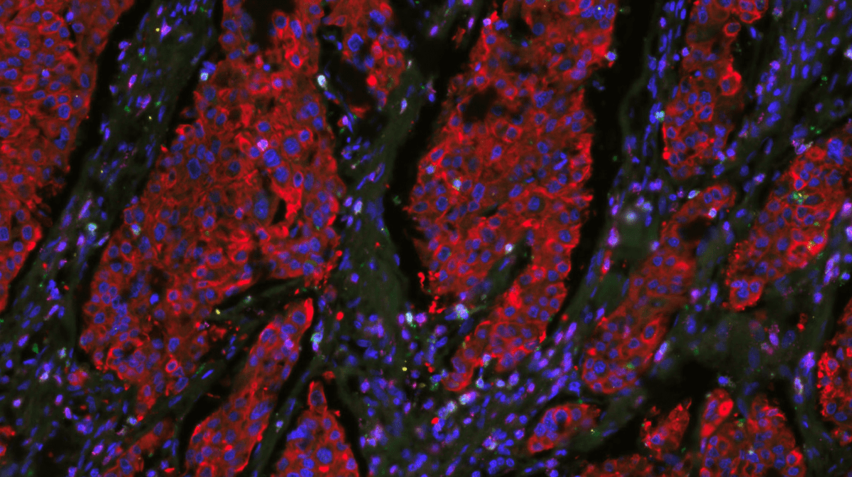 How Many Markers are the Right Amount for Multiplex Tissue Imaging?