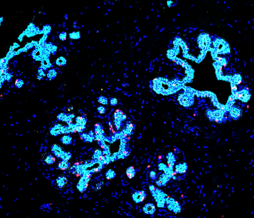 The Impact of pH on Antigen Retrieval in Immunohistochemistry