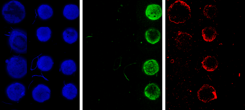 An Introduction to Jython Coding: Using Python with ImageJ