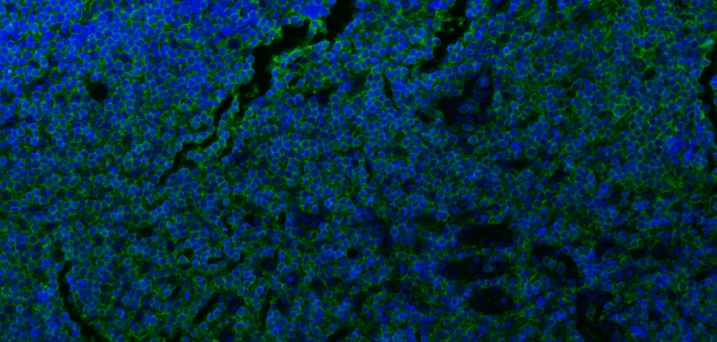 How Highly Multiplexed Immunofluorescent Labeling Service Transforms ... How Highly Multiplexed Immunofluorescent Labeling Service Transforms ...