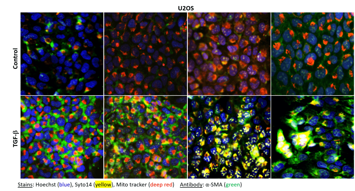 Cell Painting Assay