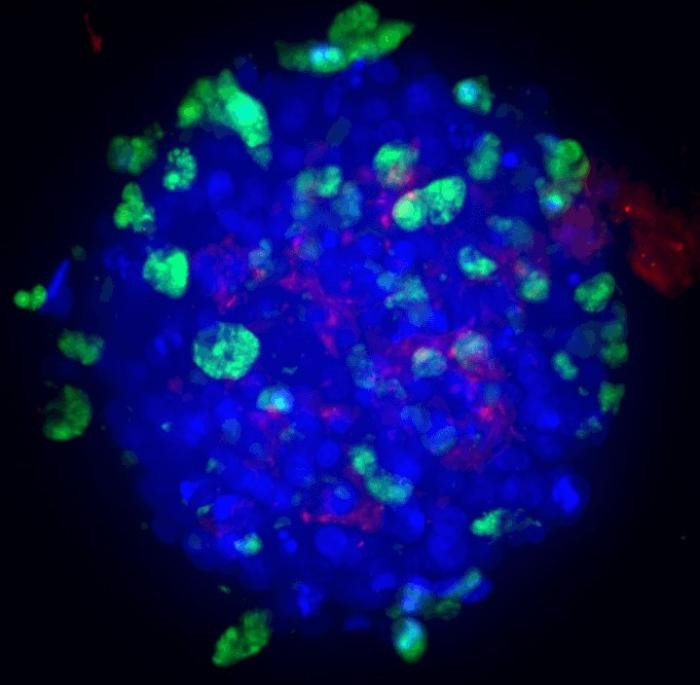 Understanding Liver Fibrosis and the Role of In Vitro Models