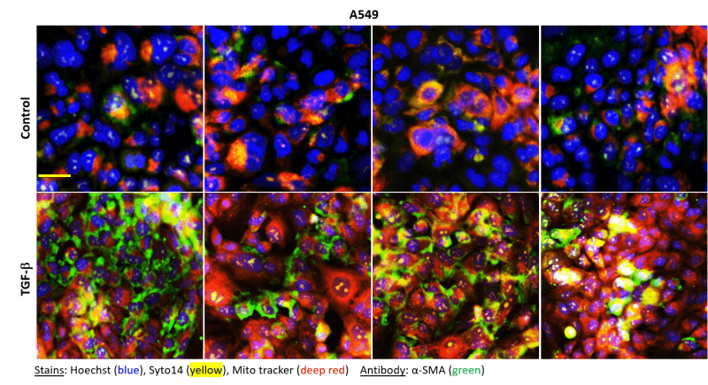 Cell Painting Assay