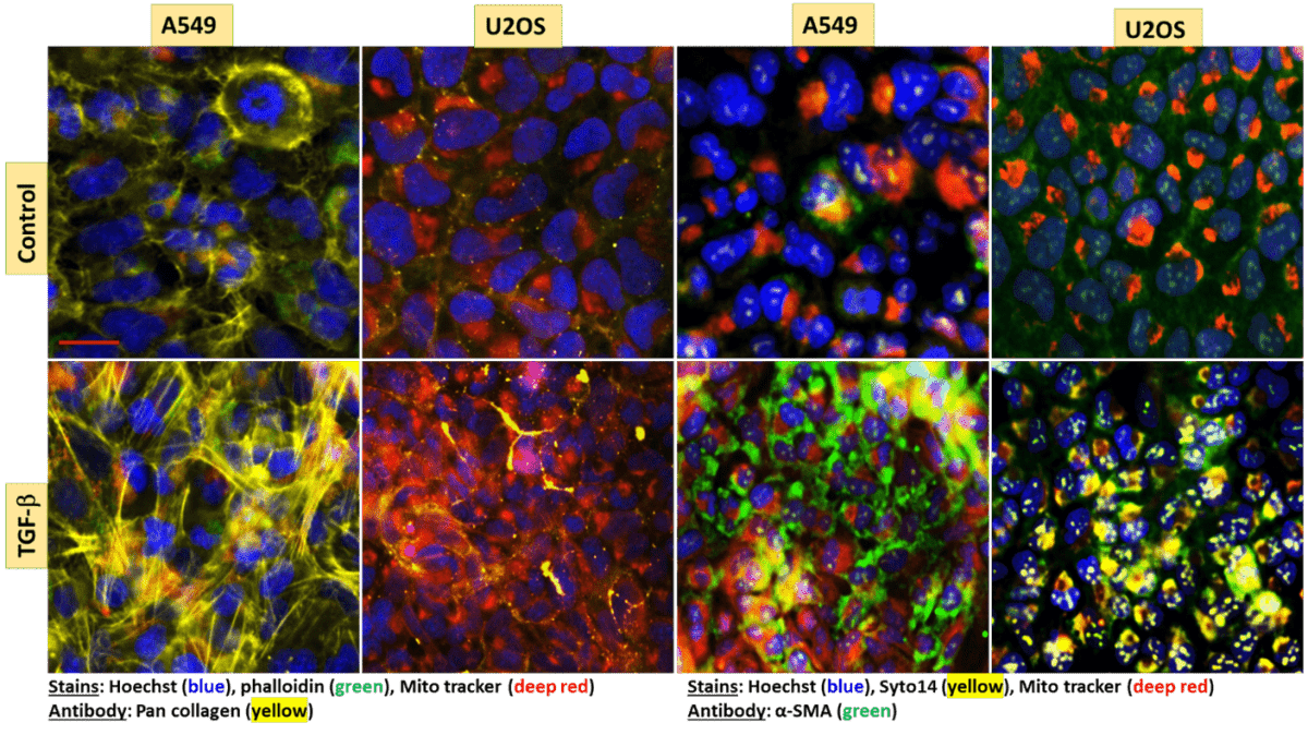 Combining Cell Painting and Antibody Labeling