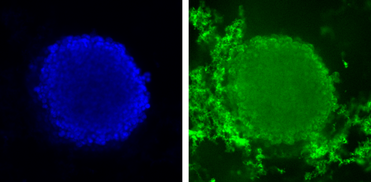 Antibody Penetration Assay; Image Analysis Workflow