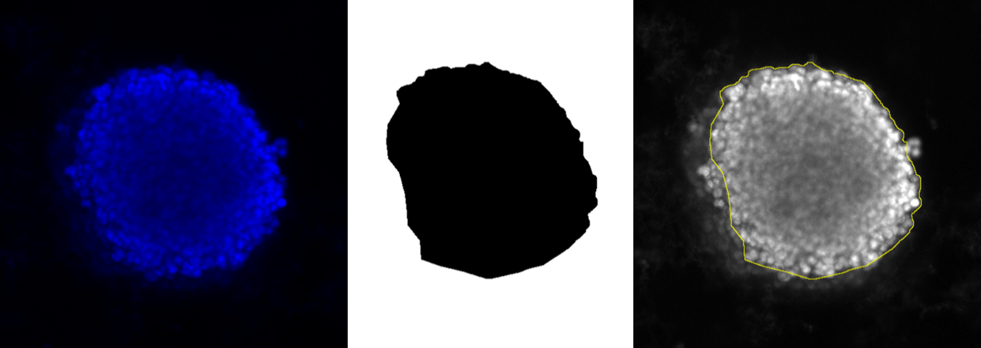 Antibody Penetration Assay; Image Analysis Workflow