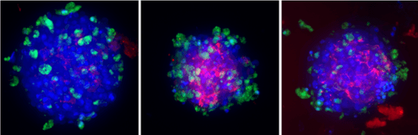 Human Hepatocyte Spheroid Model to Study NASH | Visikol