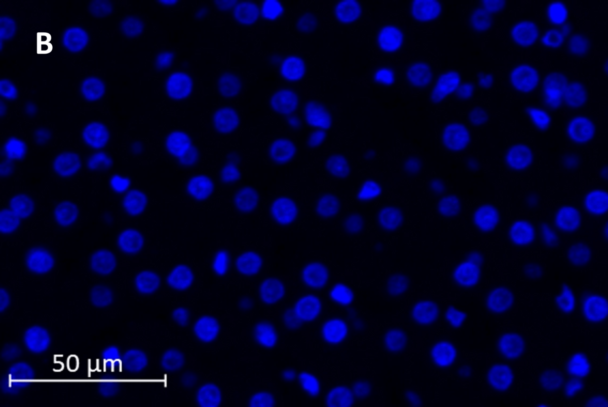 Positive, Secondary, and Unlabeled Controls in IF Tissue Labeling